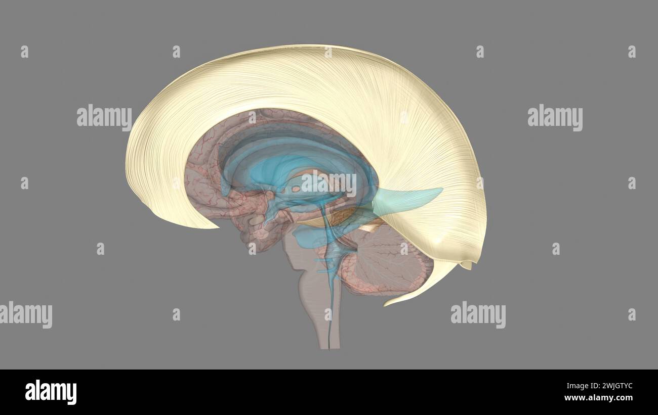 The falx cerebri and tentorium cerebelli are thin dural structures ...