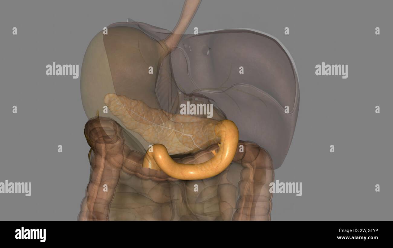 Small intestine tumor illustration hi-res stock photography and images ...