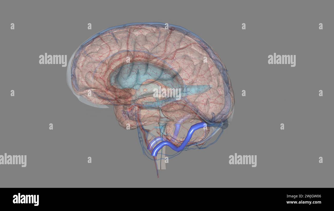 Sigmoid artery hi-res stock photography and images - Alamy