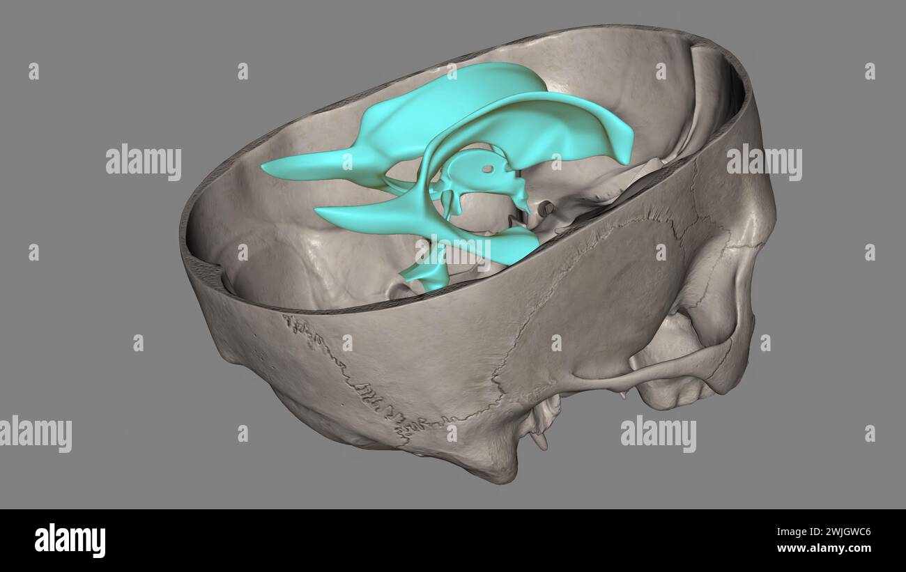 Ventricles and csf hi-res stock photography and images - Alamy