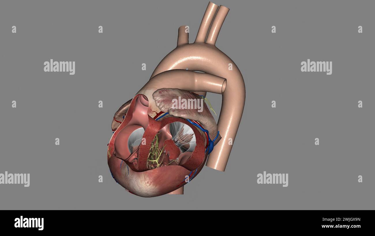 Right and left atria hi-res stock photography and images - Alamy