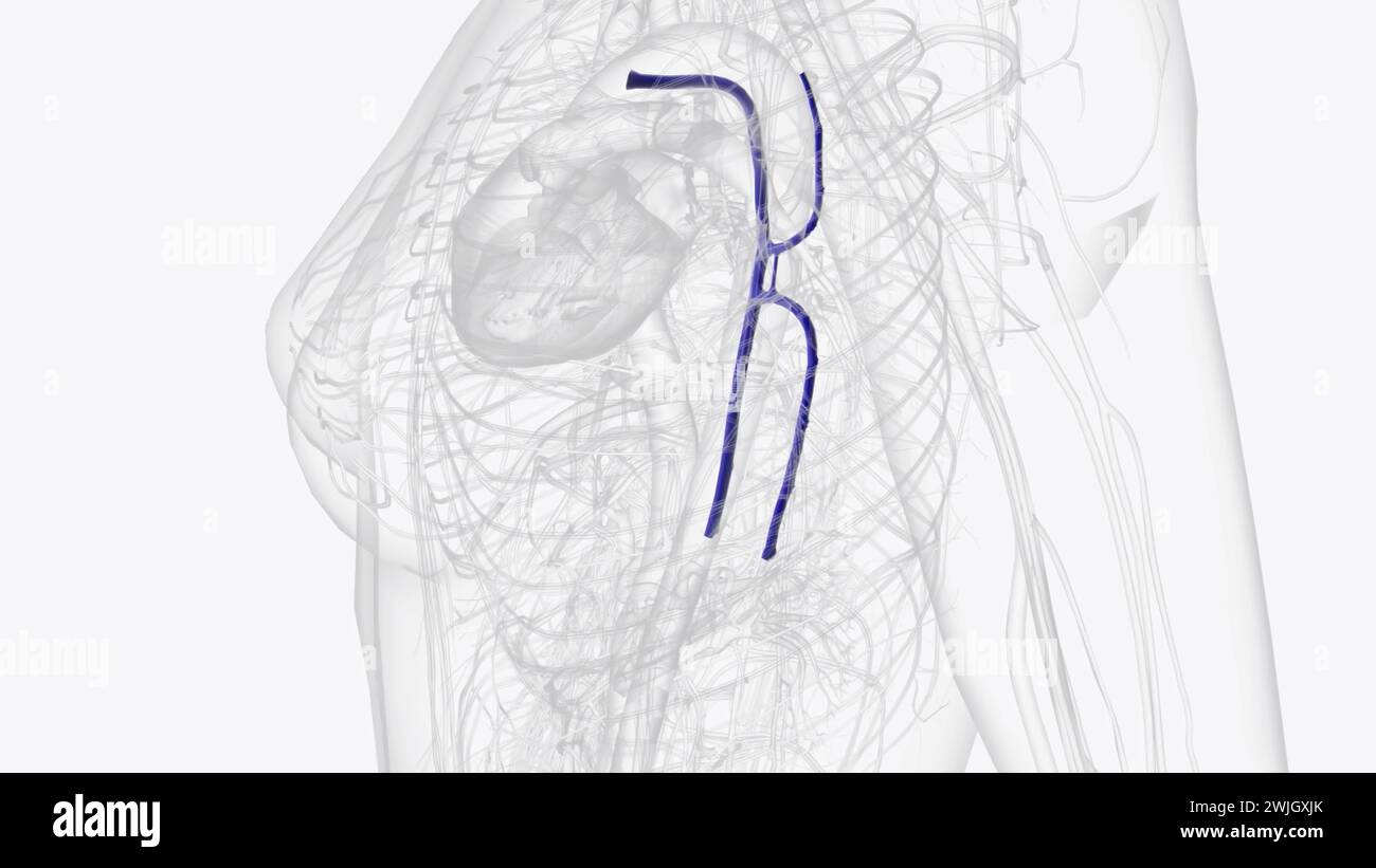 The azygos vein forms from the junction of the right subcostal veins ...