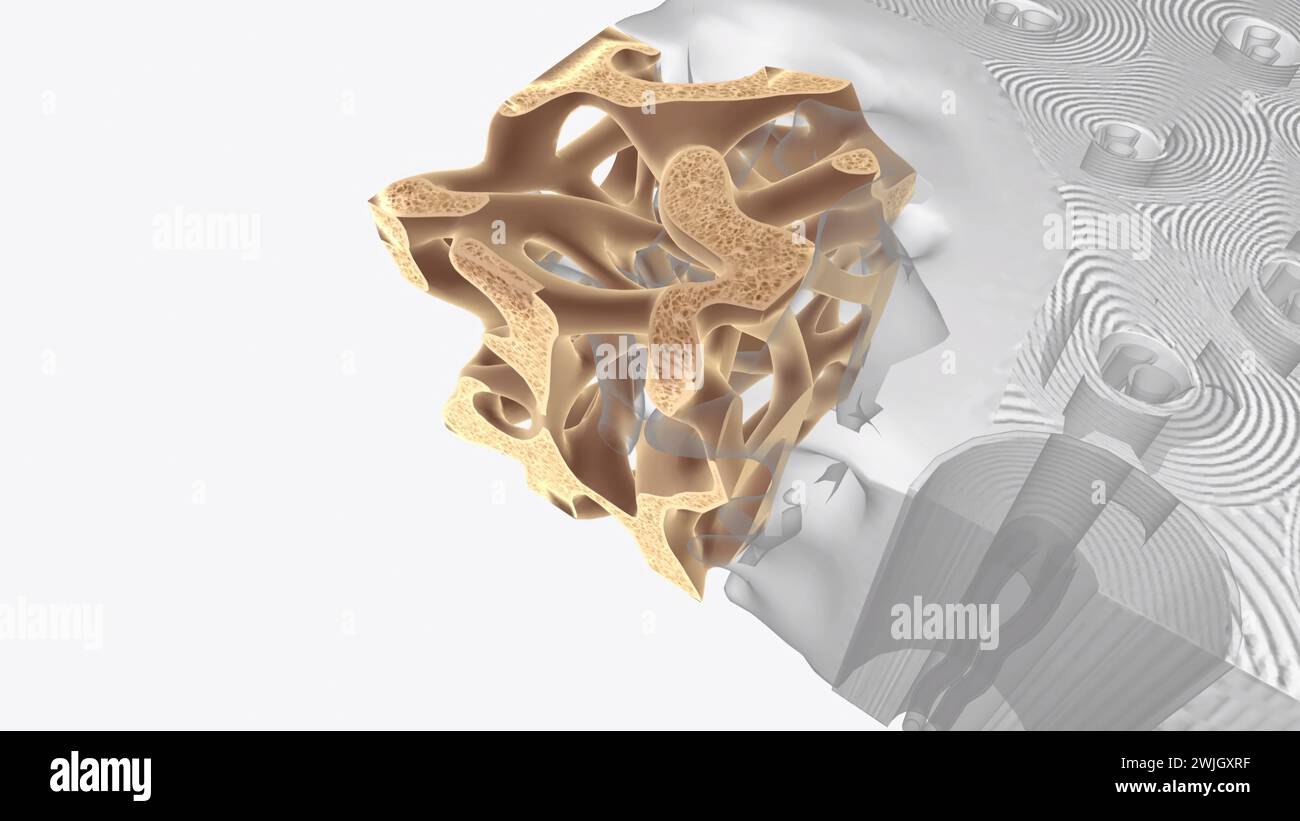 Cancellous bone hi-res stock photography and images - Alamy