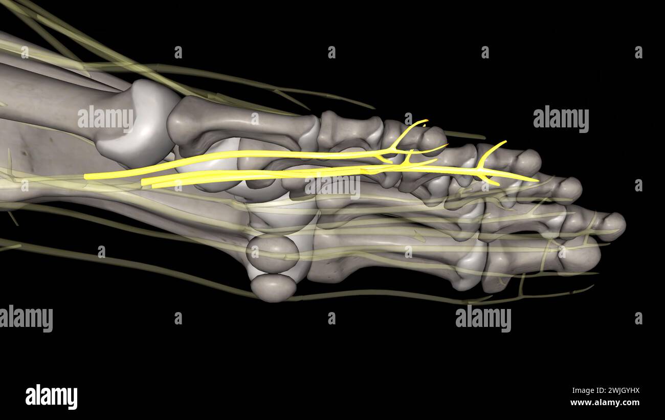 Plantar lateral hi-res stock photography and images - Alamy
