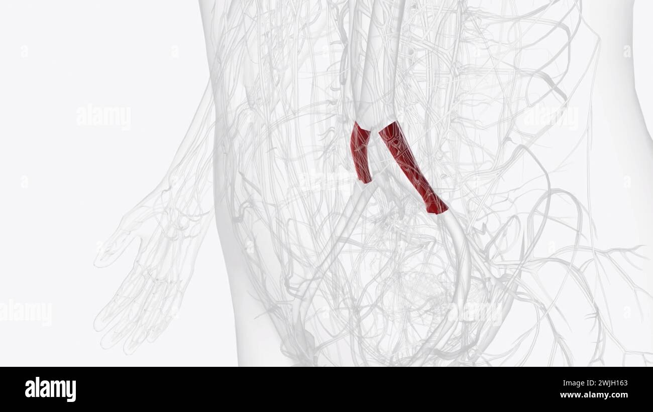 Common iliac artery hi-res stock photography and images - Alamy