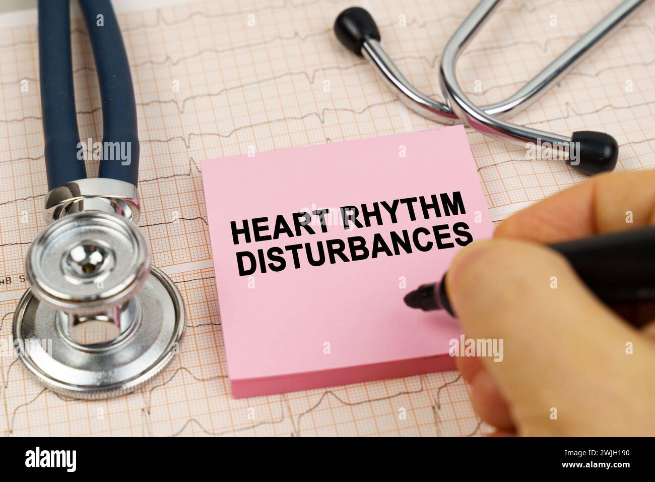 Disturbance of the cardiac rhythm hi-res stock photography and images ...