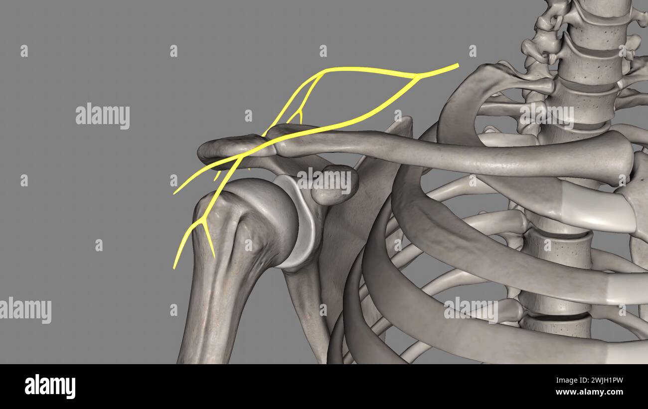 The suprascapular nerve is the lateral branch of the superior trunk of ...