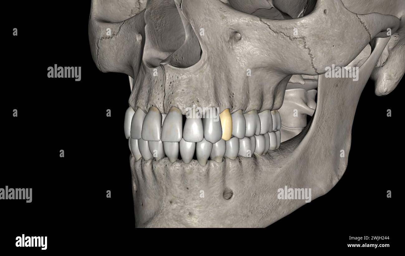 The mandibular first premolar has a bulkier crown compared to the ...