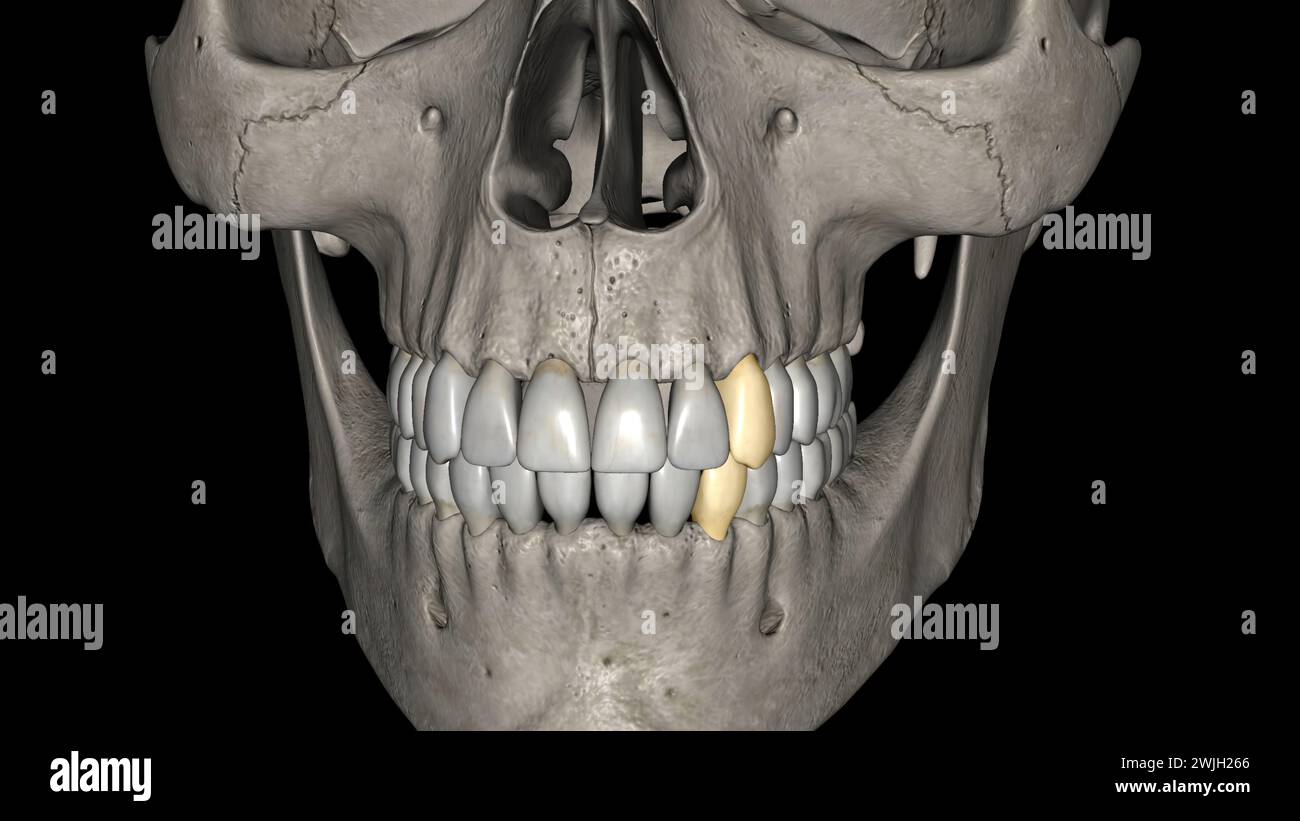 Maxillary premolar hi-res stock photography and images - Alamy