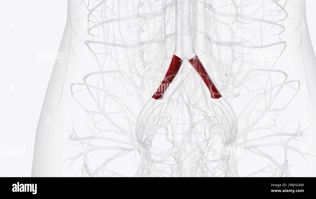 Common iliac artery hi-res stock photography and images - Alamy