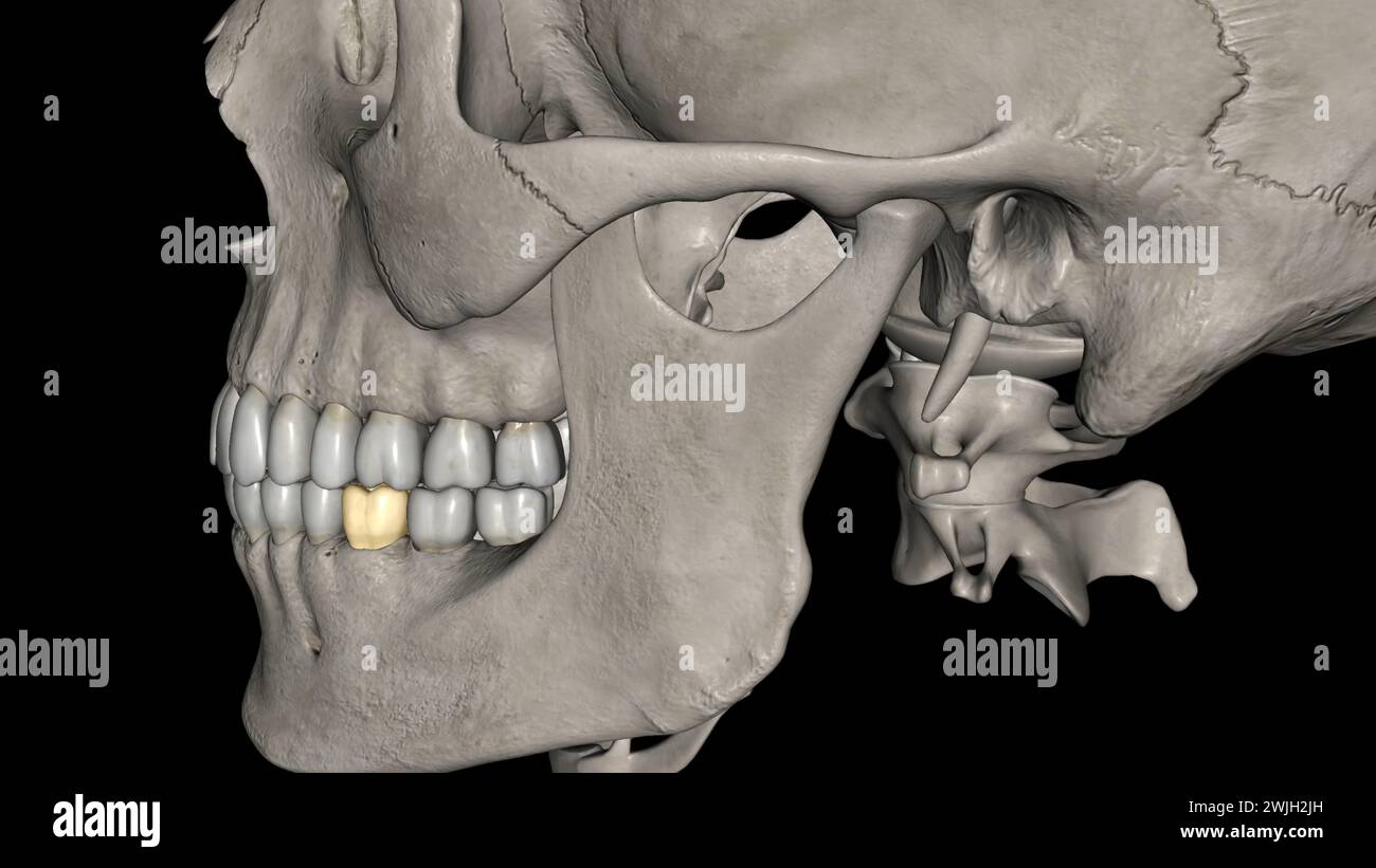 The mandibular first molar usually has two roots, a mesial and a distal ...