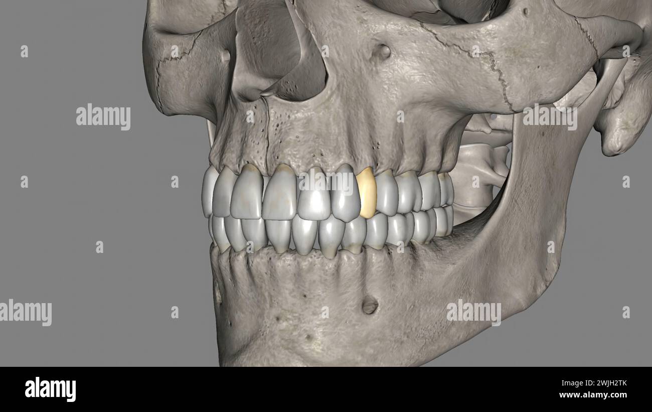 The Mandibular First Premolar Has A Bulkier Crown Compared To The Cuspid Yet Its Root Is More