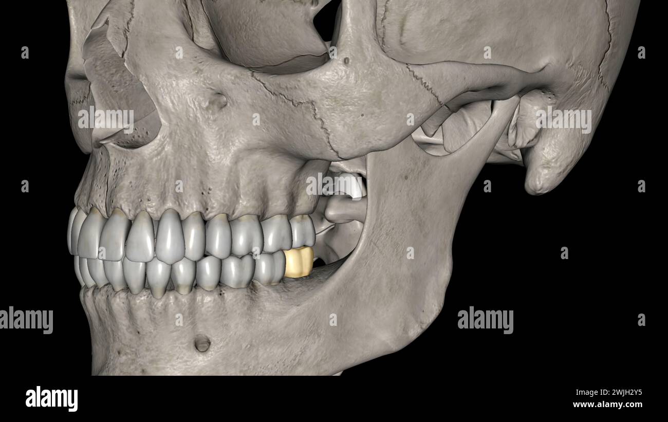 The mandibular third molar is also referred as the wisdom tooth 3d ...