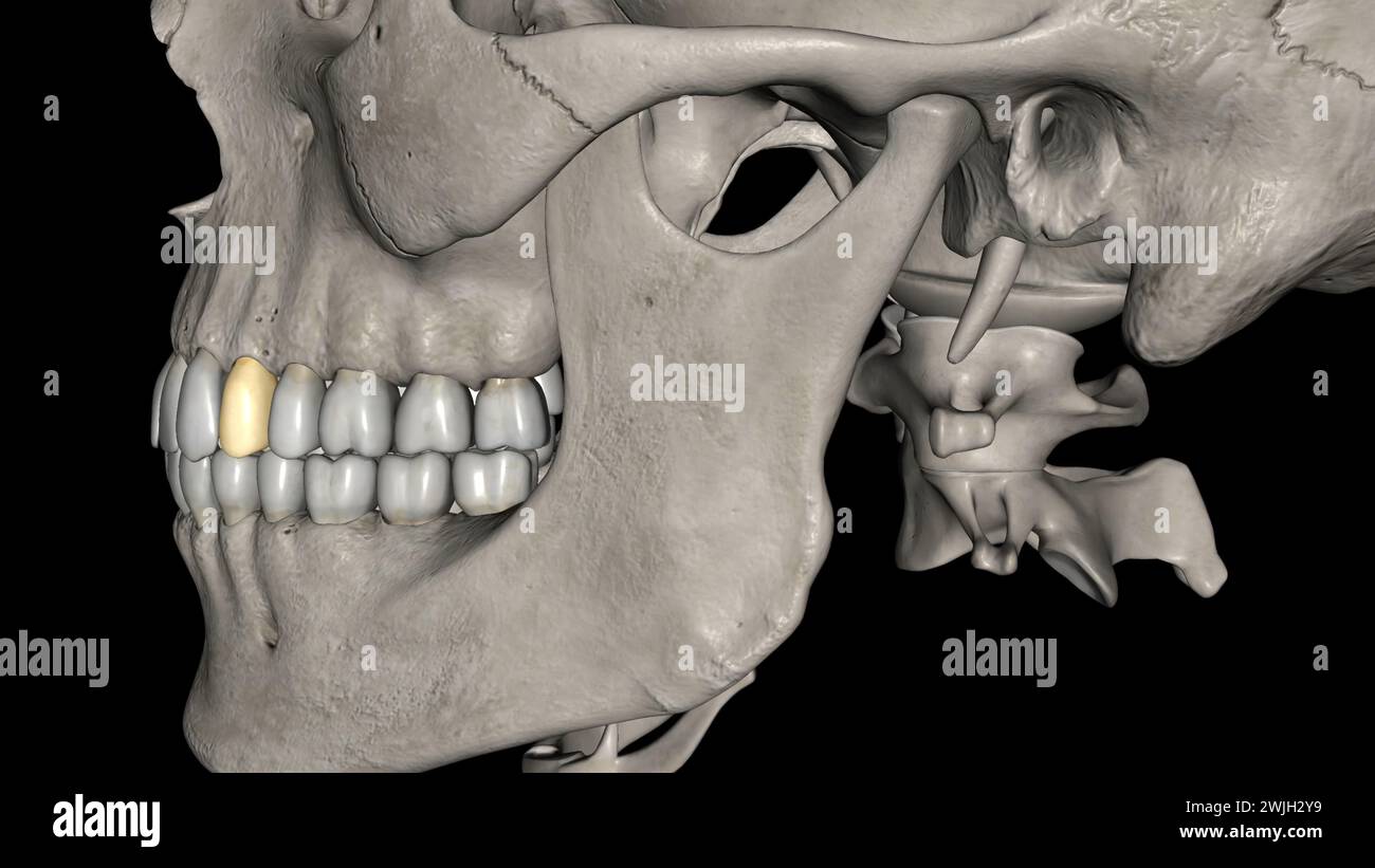 The Mandibular First Premolar Has A Bulkier Crown Compared To The Cuspid Yet Its Root Is More