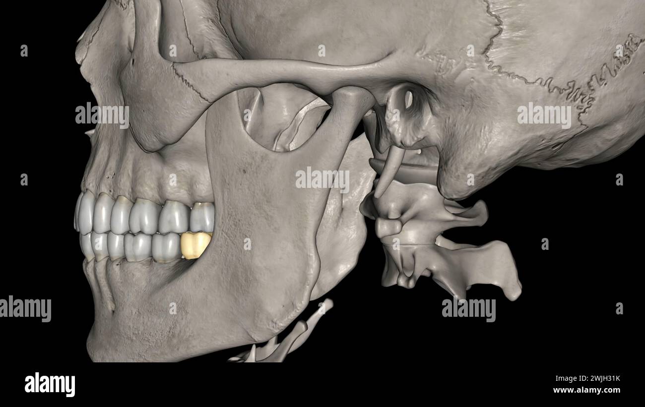 The mandibular third molar is also referred as the wisdom tooth 3d ...