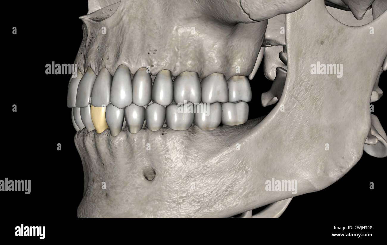 Mandibular lateral incisor hi-res stock photography and images - Alamy