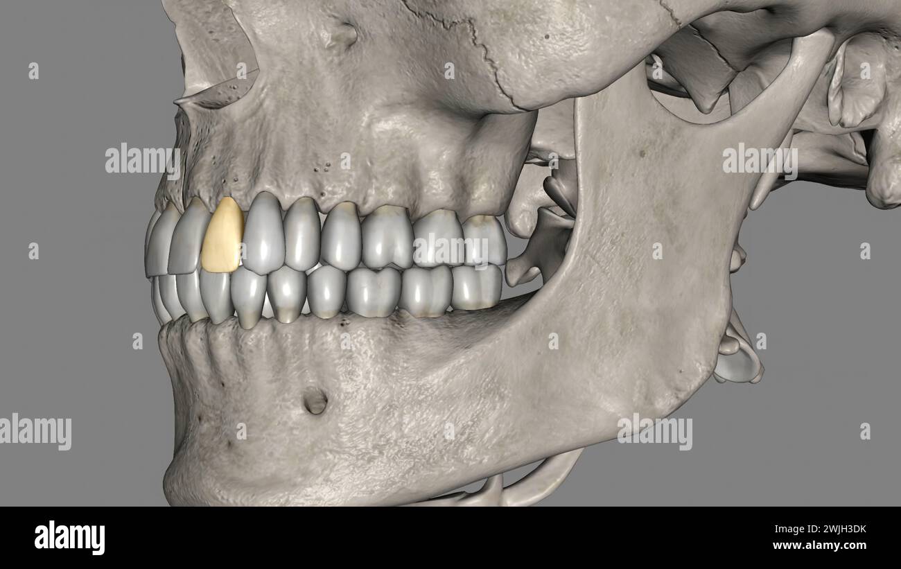 The maxillary lateral incisors are a pair of upper (maxillary) teeth ...