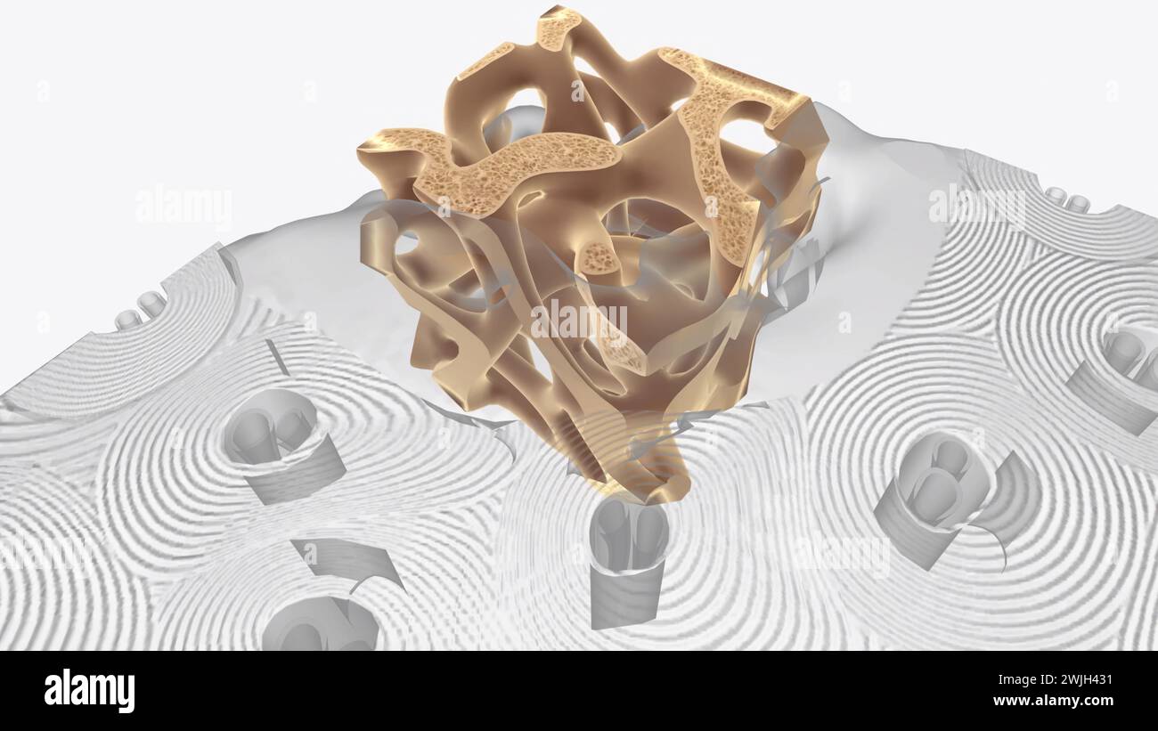 Cancellous bone hi-res stock photography and images - Alamy