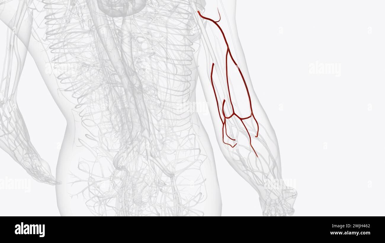 Pulmonary artery catheterization hi-res stock photography and images ...