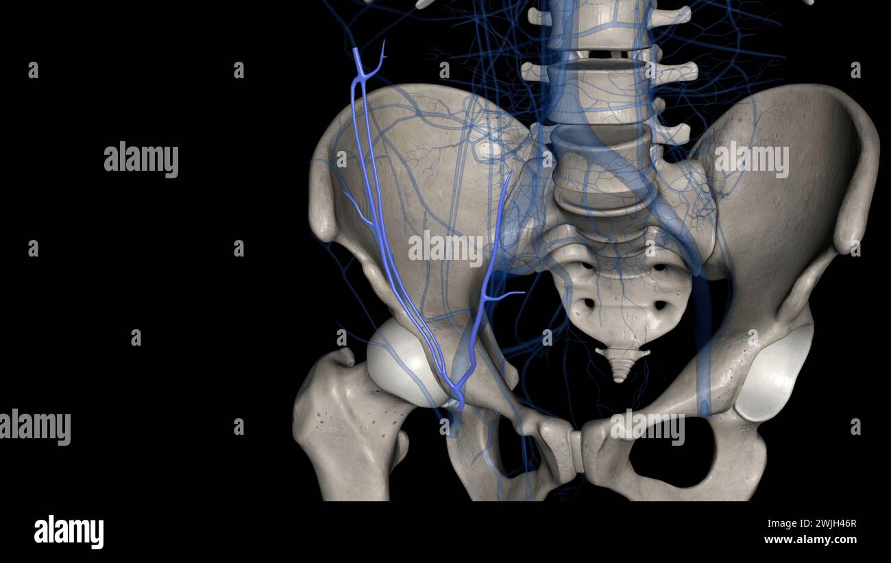 The superficial epigastric vein runs upward and medially and drains the ...