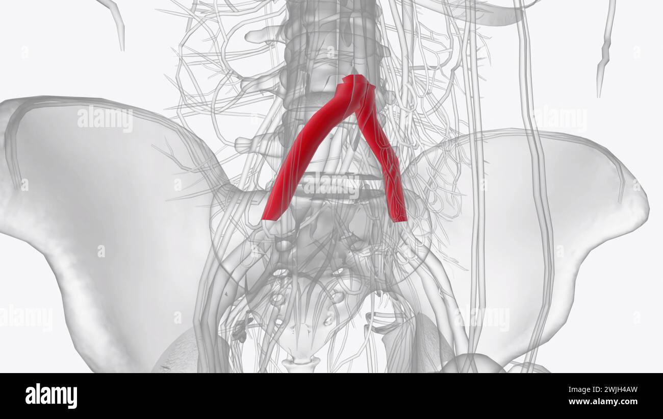 Common iliac artery hi-res stock photography and images - Alamy