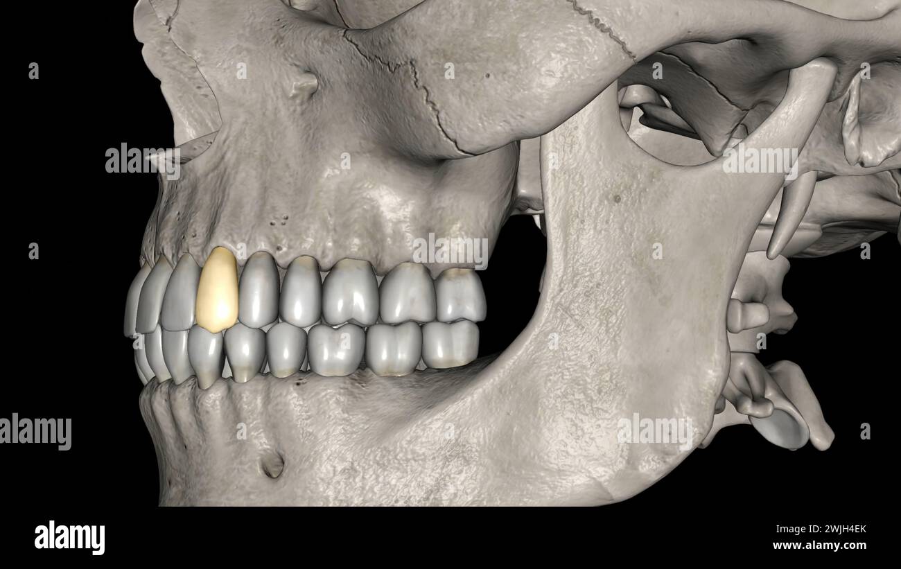 The maxillary canine presents with only one cusp on its incisal surface ...