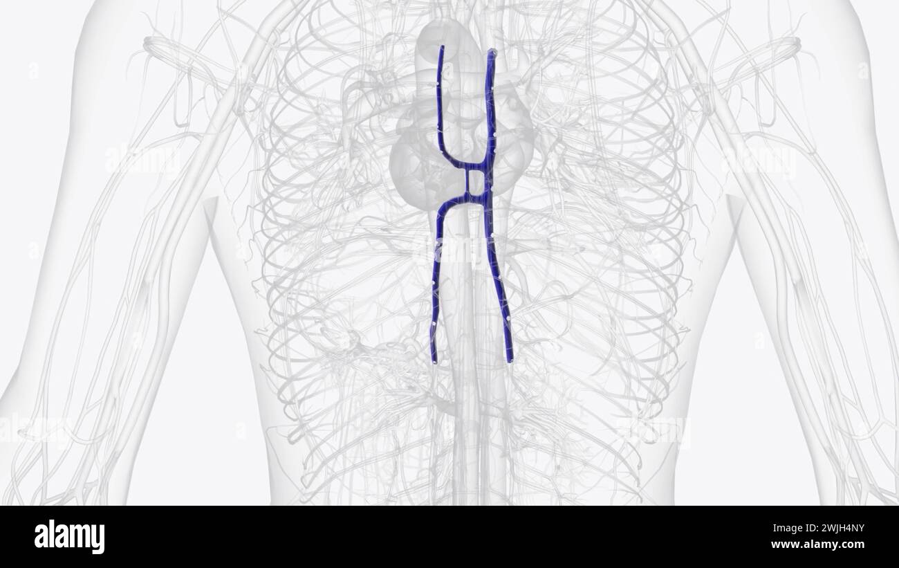 The azygos vein forms from the junction of the right subcostal veins ...