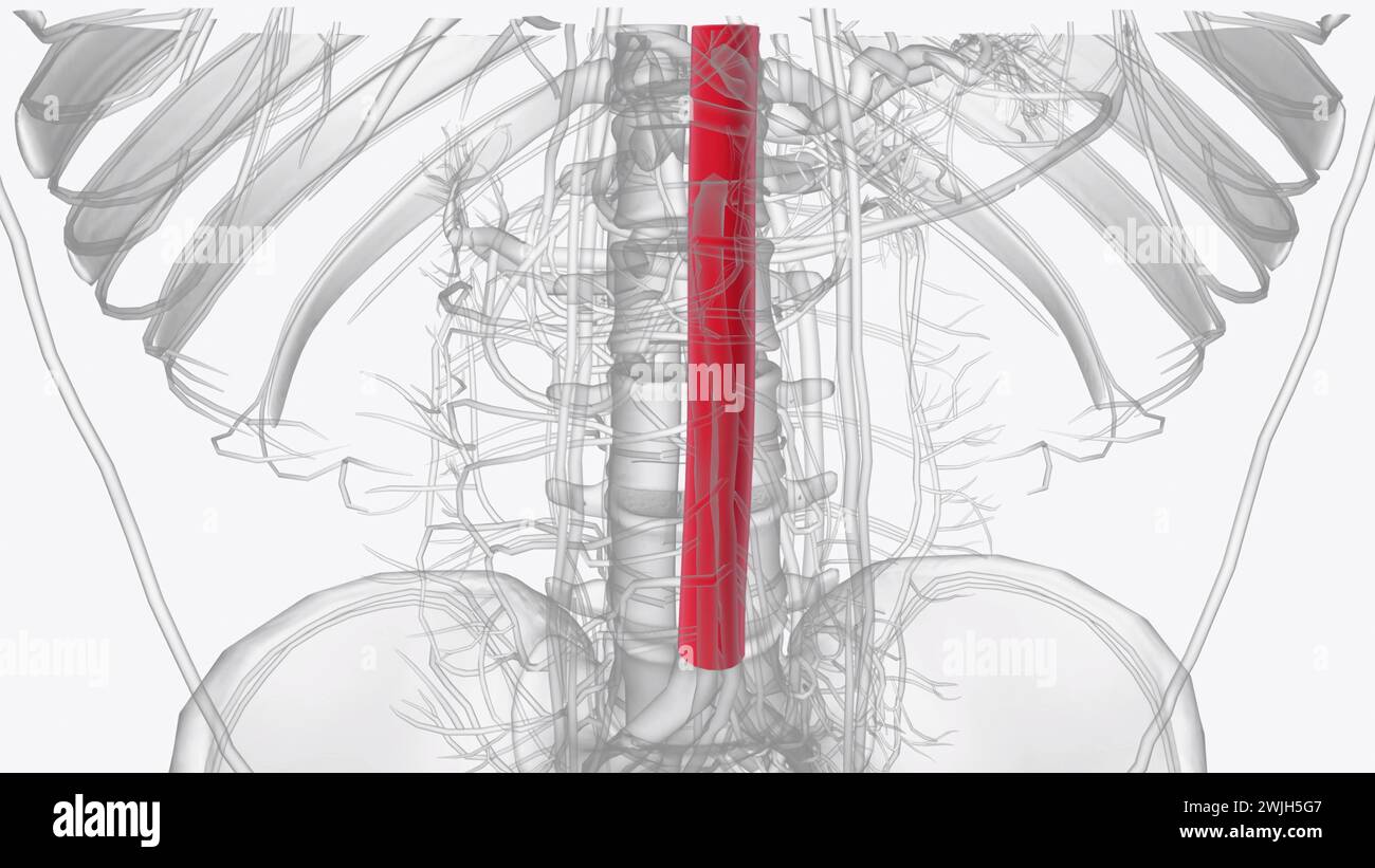 Stent in the abdominal aorta hi-res stock photography and images - Alamy