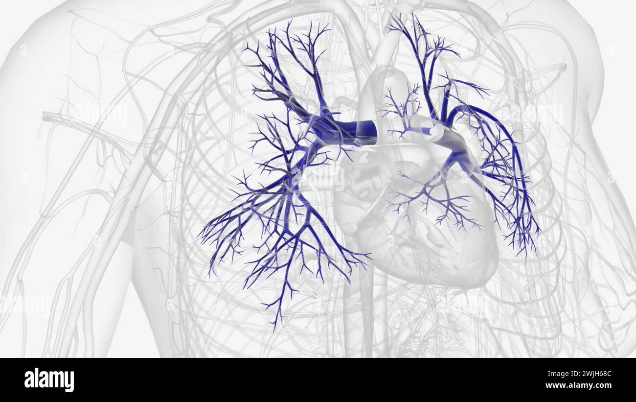 pulmonary arteries carry oxygen-poor blood from your heart to your ...