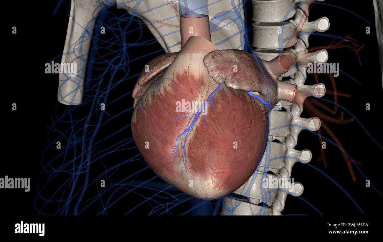 The great cardiac vein (left coronary vein) is a vein of the heart3d ...