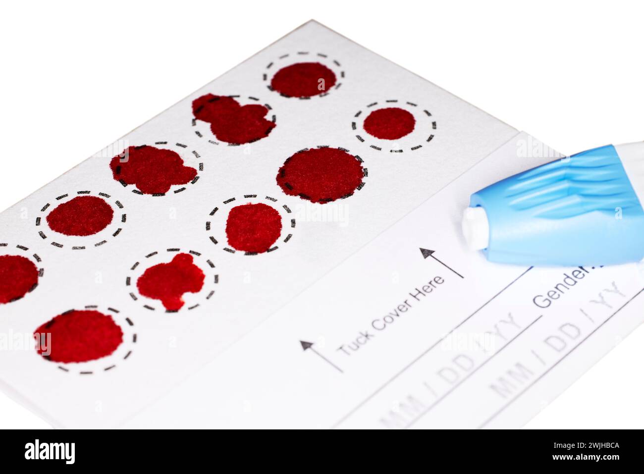 A Completed Blood Spot test card with droplets of blood for hormone ...