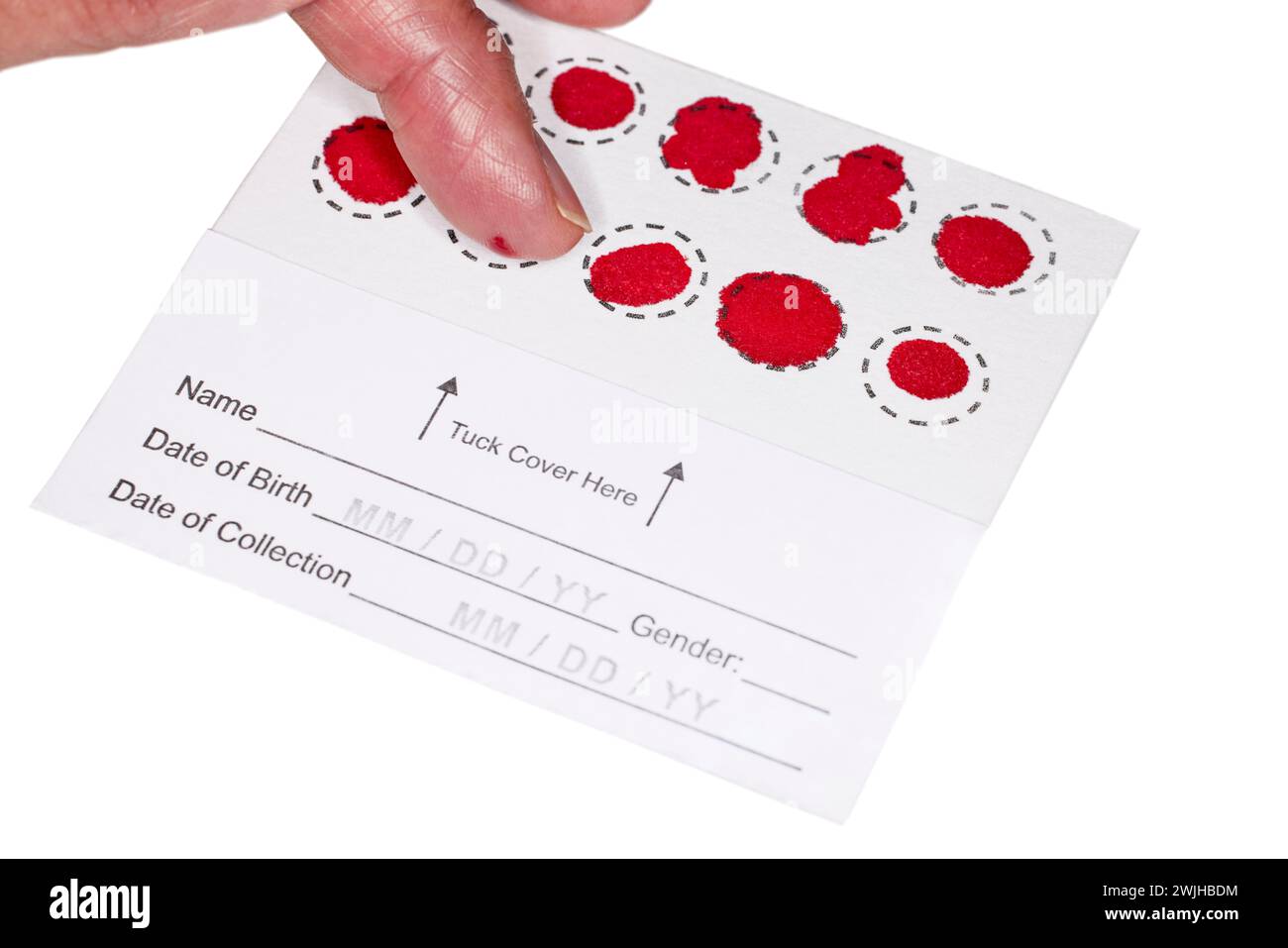 Blood Spot test card with droplets of blood for hormone testing Stock ...