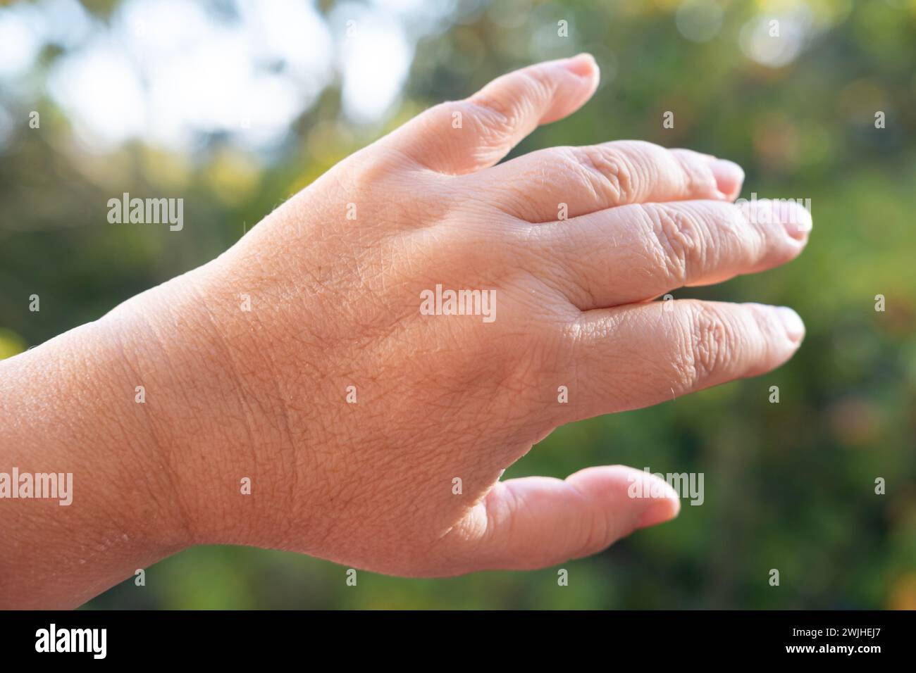 closeup female hands 55 years old with dry skin damage, beauty and ...
