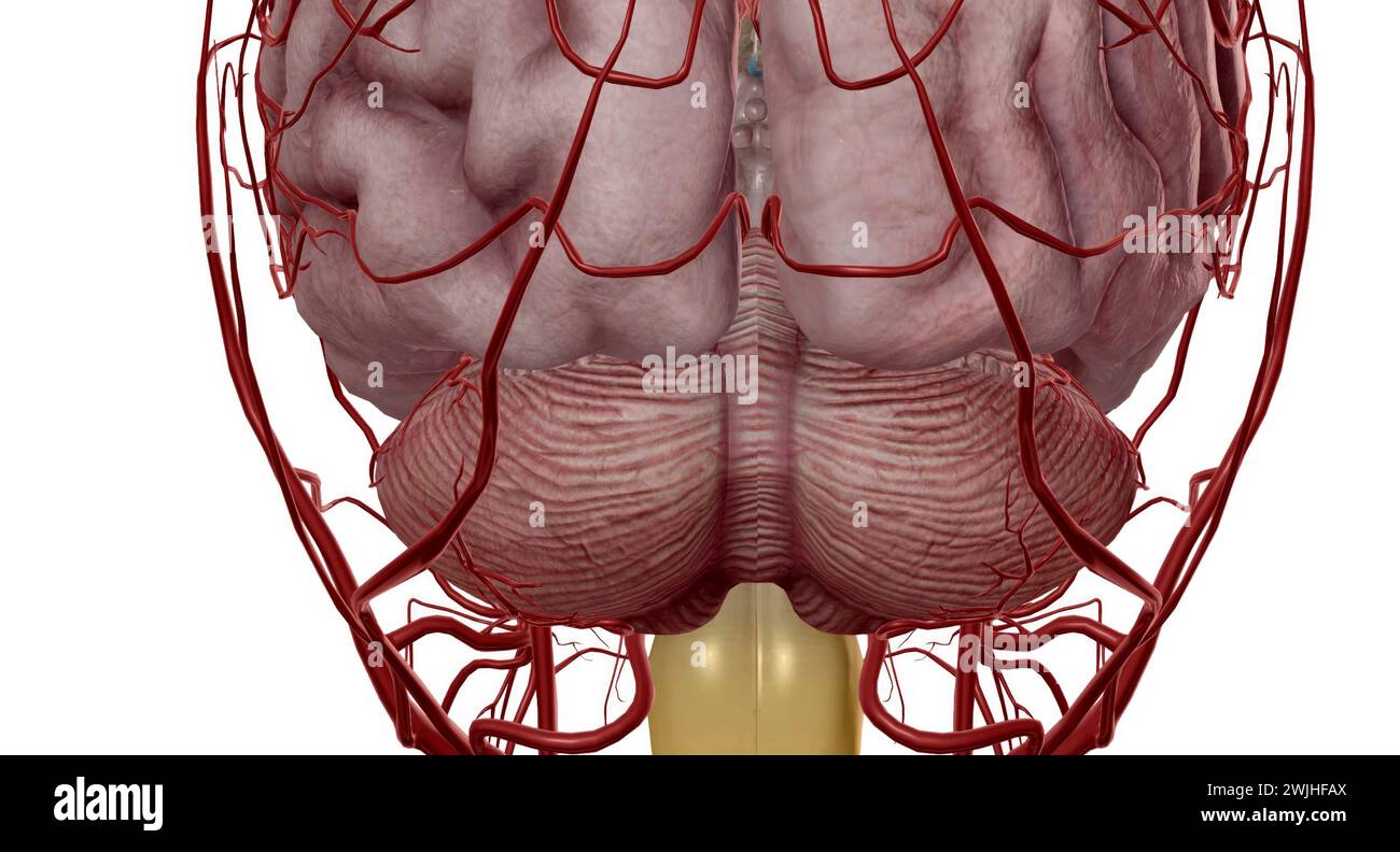 Cerebral angiogram 3d hi-res stock photography and images - Alamy