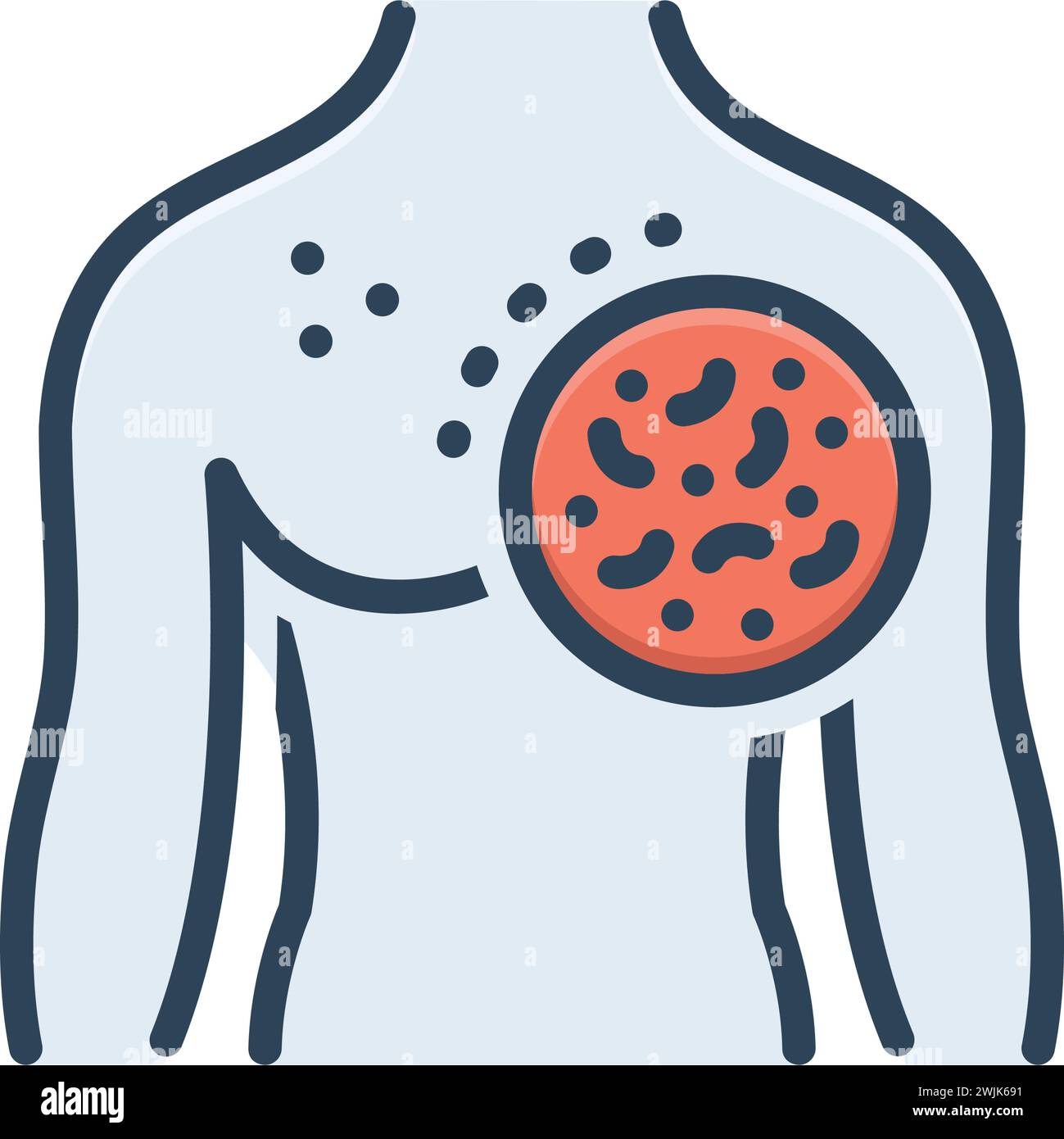 Dermatology diseases Stock Vector Images - Alamy