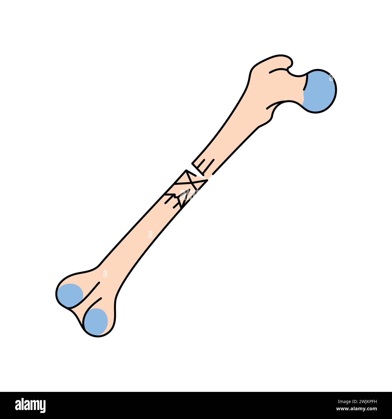 Communuted bone fracture line icon. Vector isolated element. Editable ...