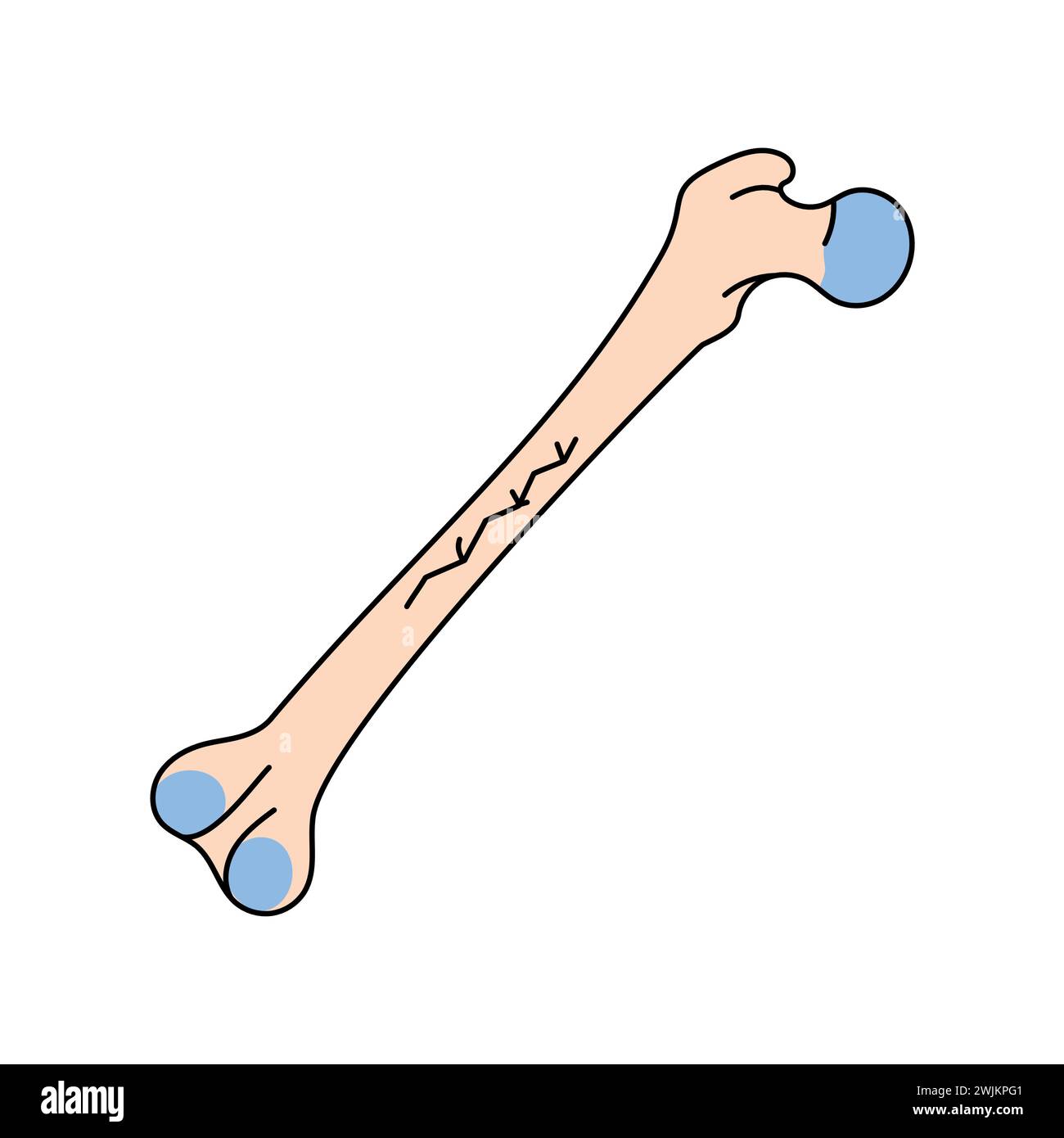 Linear bone fracture line icon. Vector isolated element. Editable ...