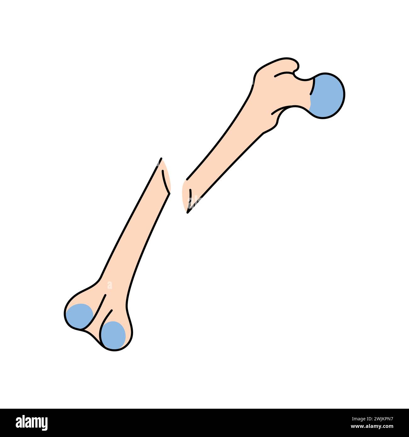 Oblique Displaced Bone Fracture Line Icon Vector Isolated Element Editable Stroke Stock Vector