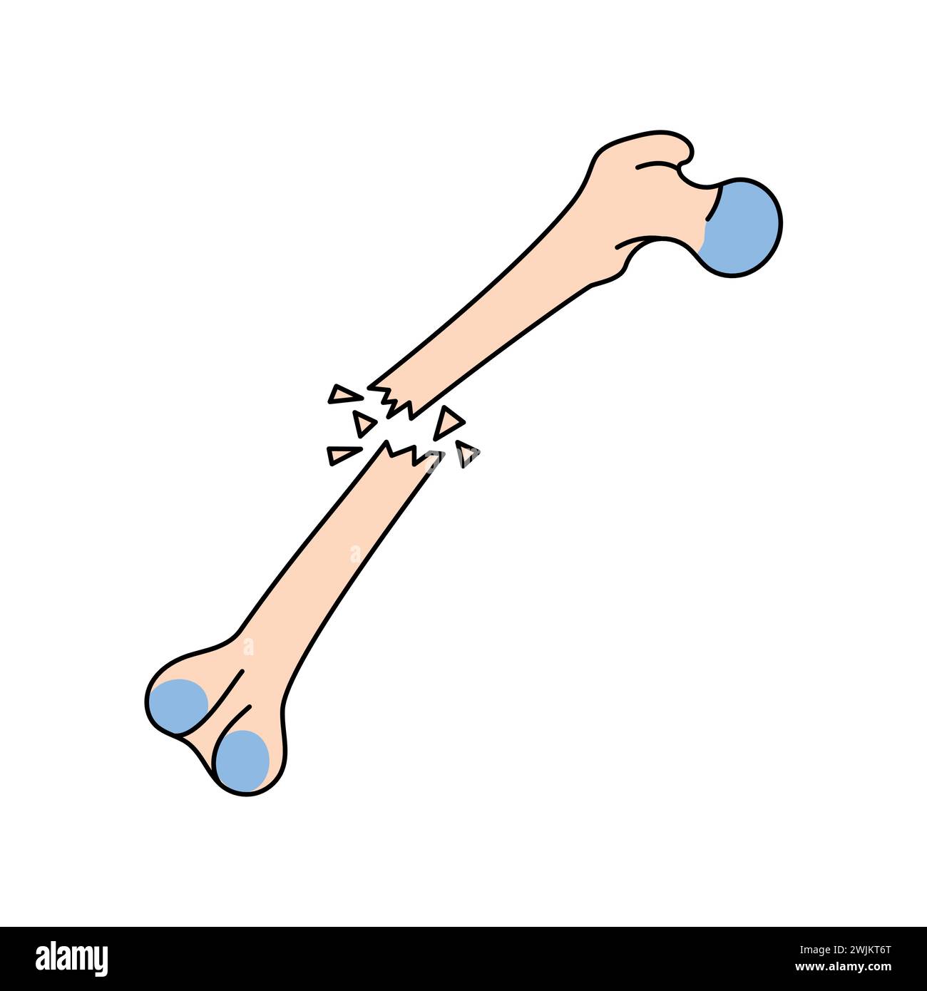 Open Bone Fracture Line Icon Vector Isolated Element Editable Stroke