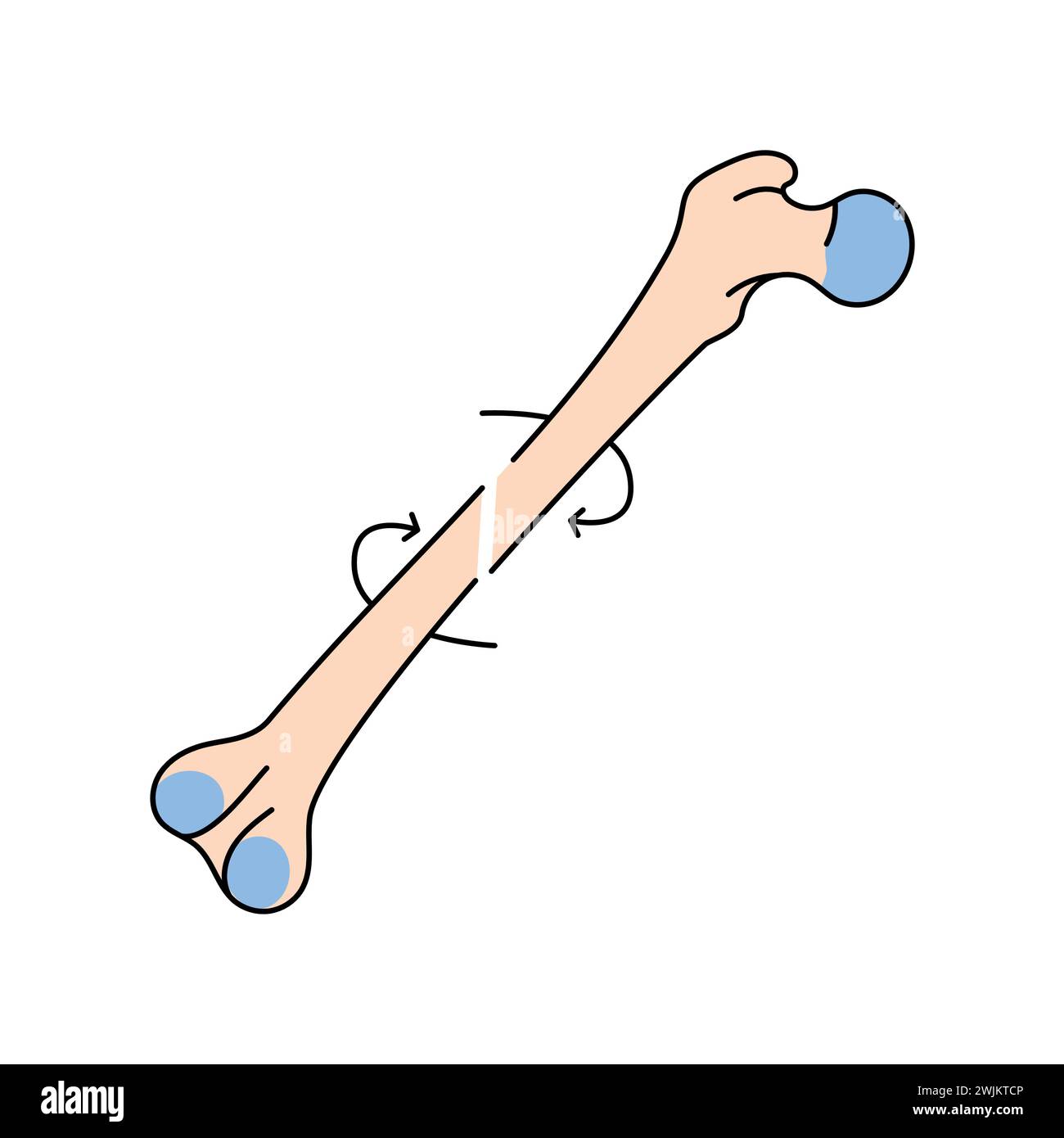 Spiral bone fracture line icon. Vector isolated element. Editable ...