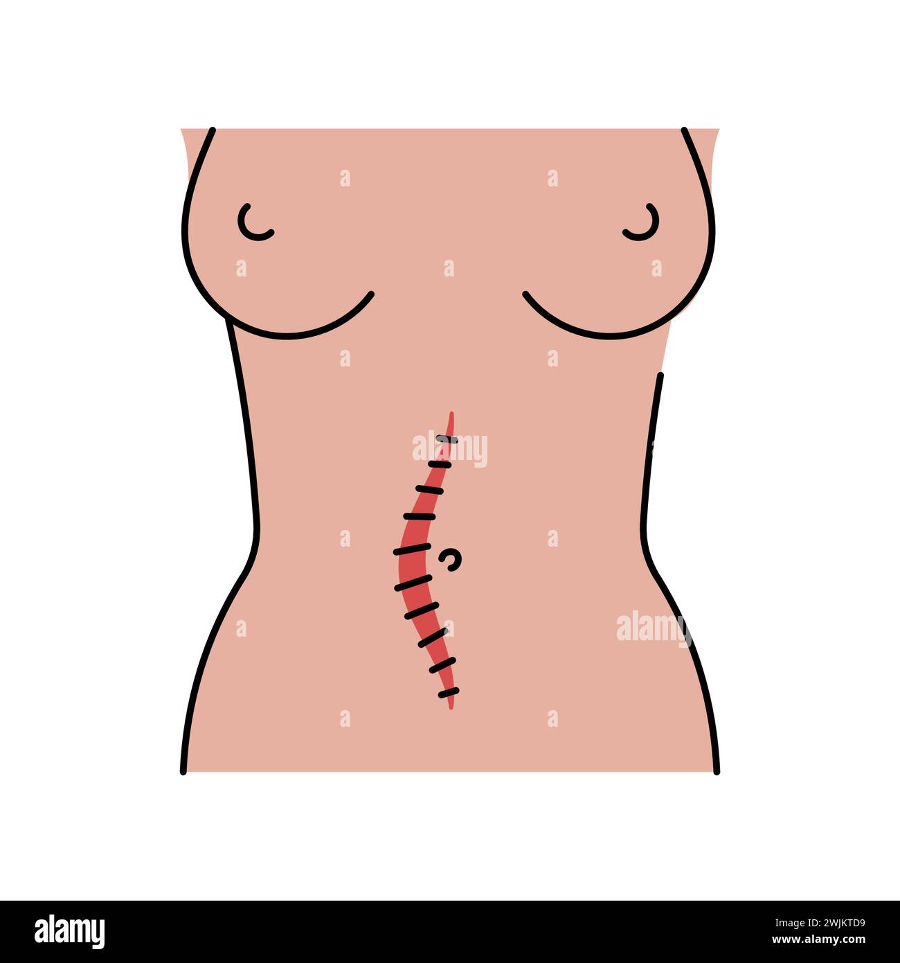 Mildline Incision Line Icon Abdominal Incisions Vector Isolated