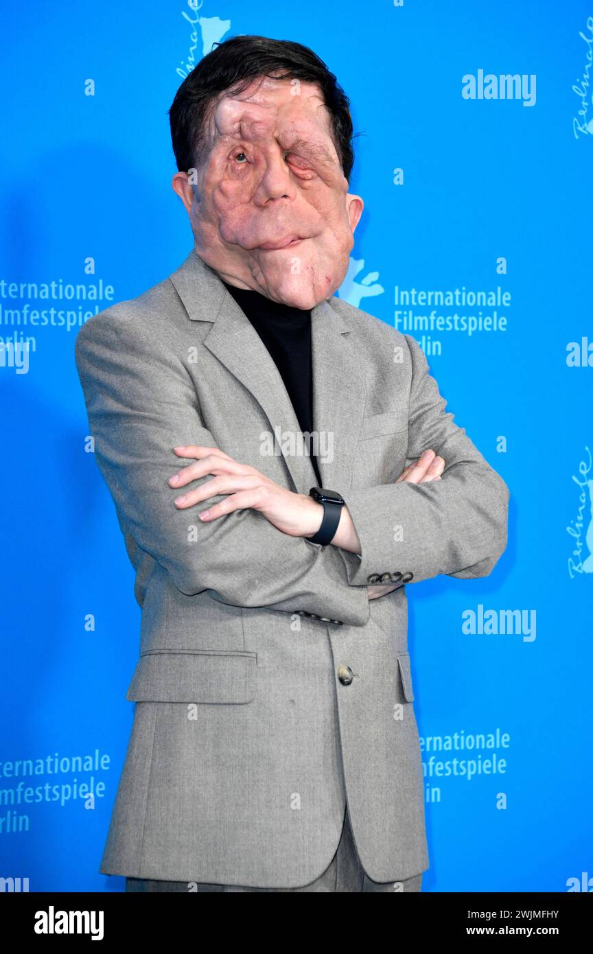 Adam Pearson beim Photocall zum Kinofilm A Different Man auf der ...