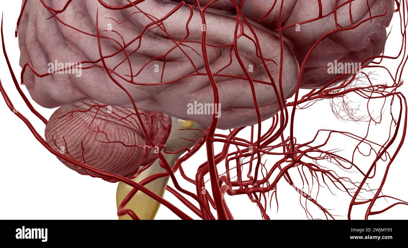 Brain artery angiogram hi-res stock photography and images - Alamy