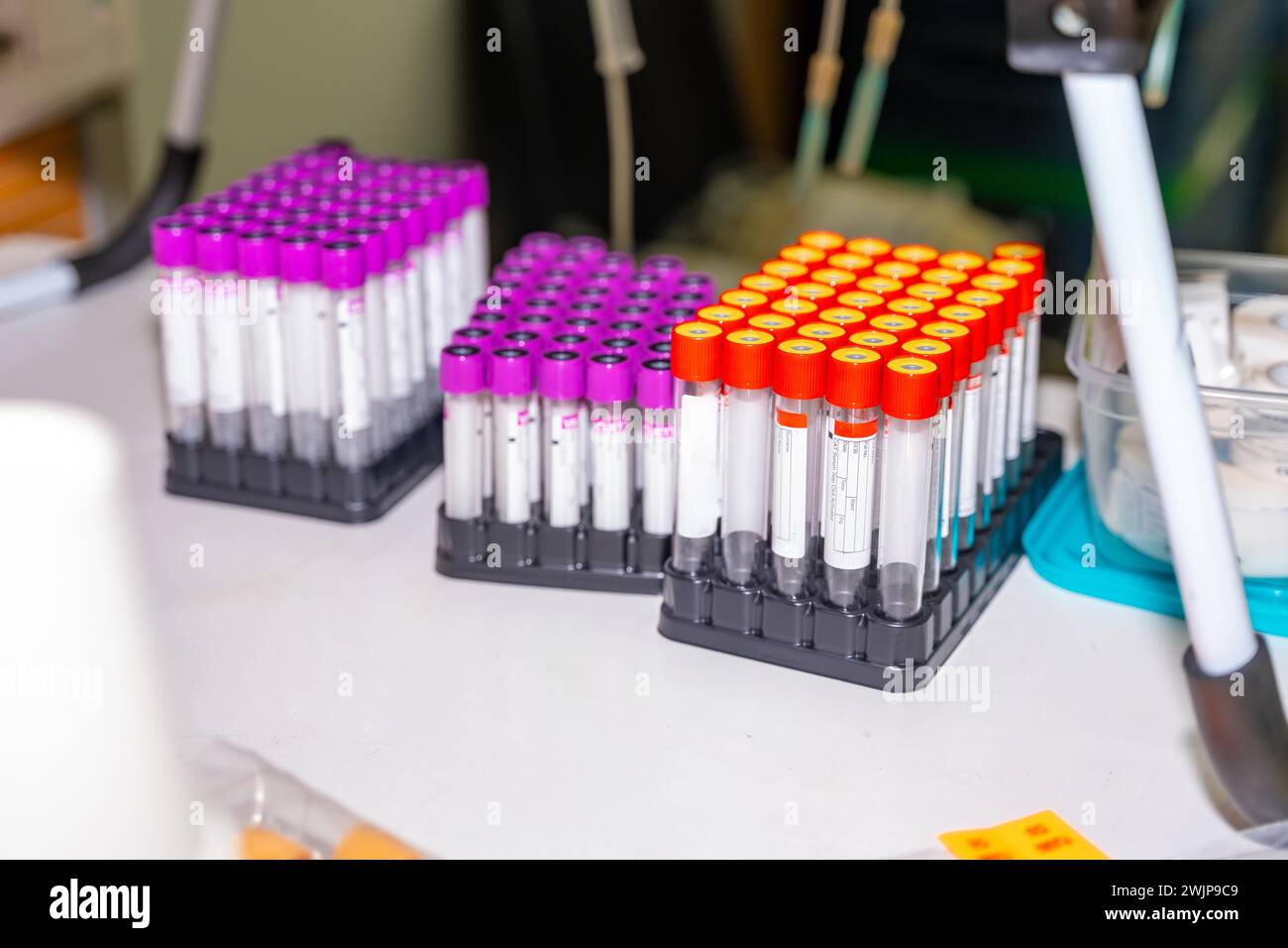 Samples of blood labeled on a table with no people Stock Photo - Alamy