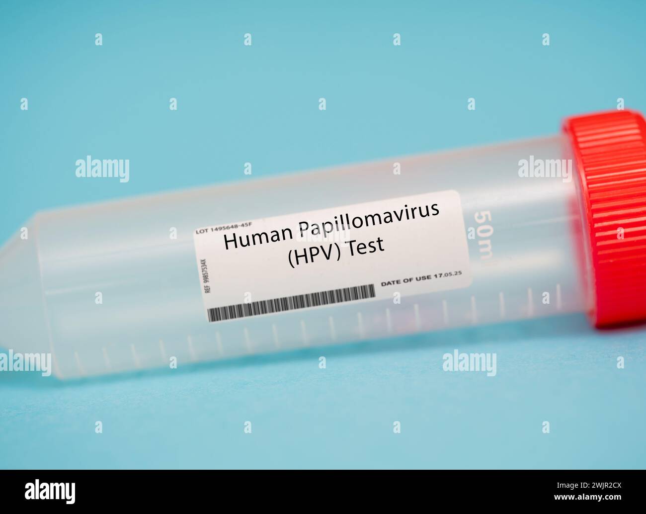 Human papillomavirus test Stock Photo - Alamy