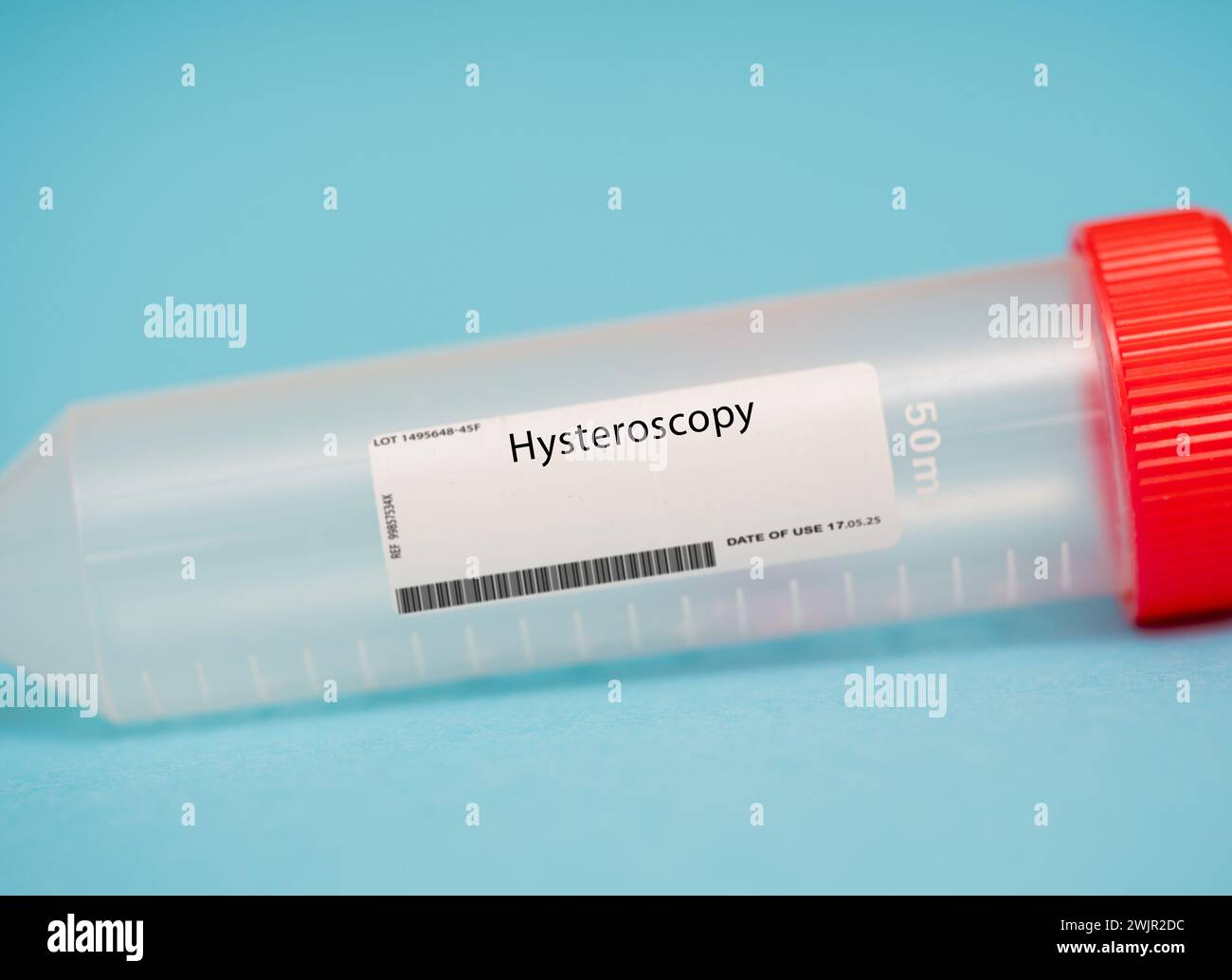 Hysteroscopy. A hysteroscopy is a procedure in which a thin, flexible ...