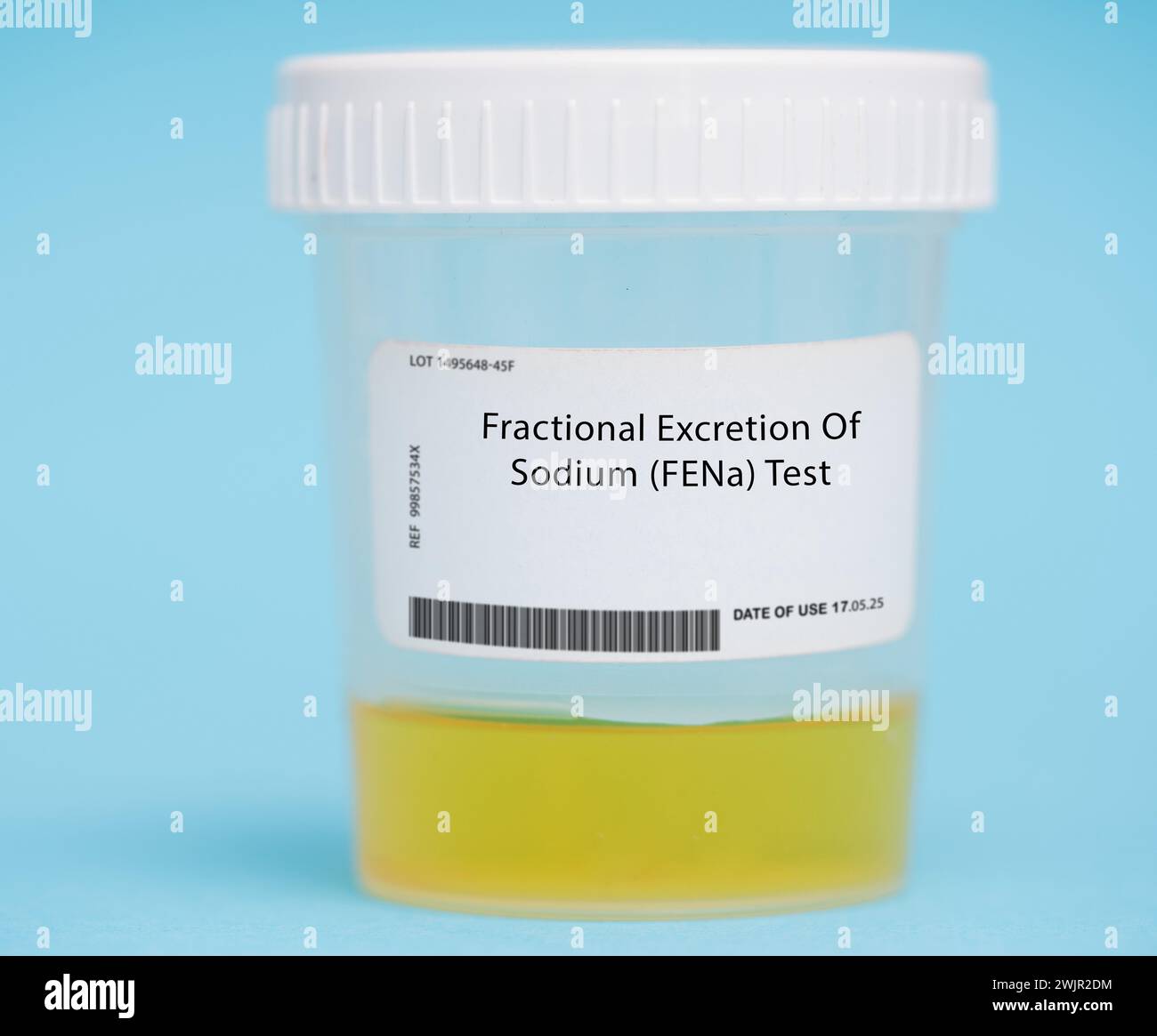 Fractional excretion of sodium test Stock Photo - Alamy