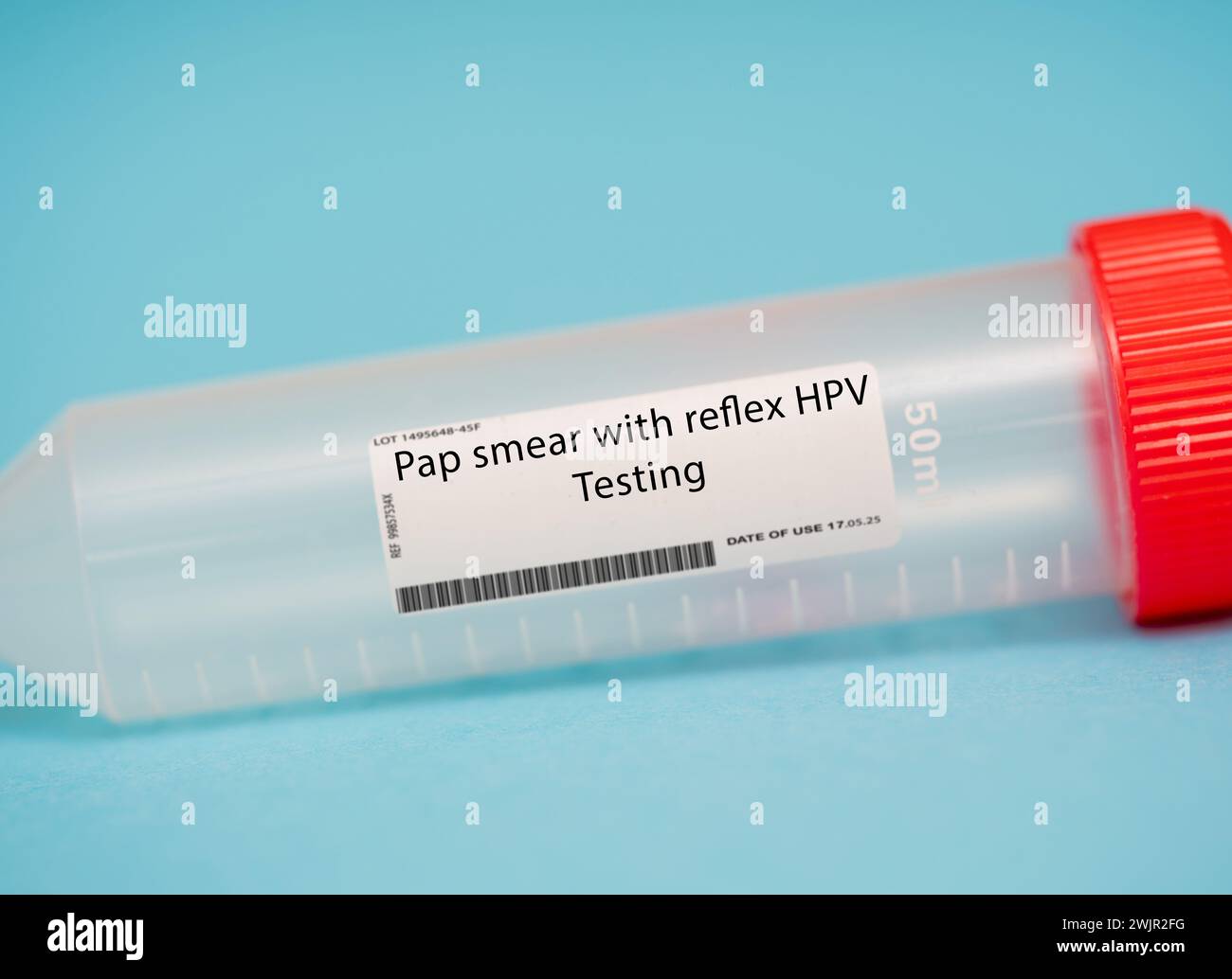 Pap smear with reflex HPV testing Stock Photo - Alamy