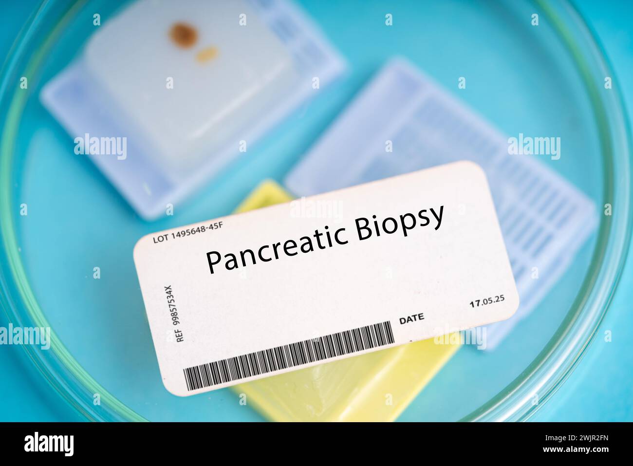 Pancreatitis test hi-res stock photography and images - Alamy