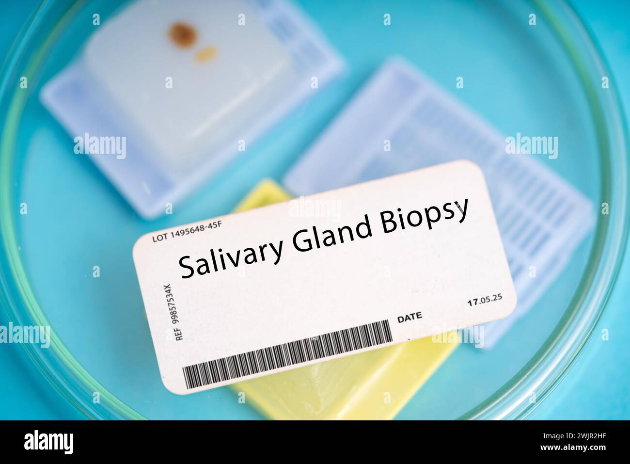 Salivary gland biopsy Stock Photo - Alamy